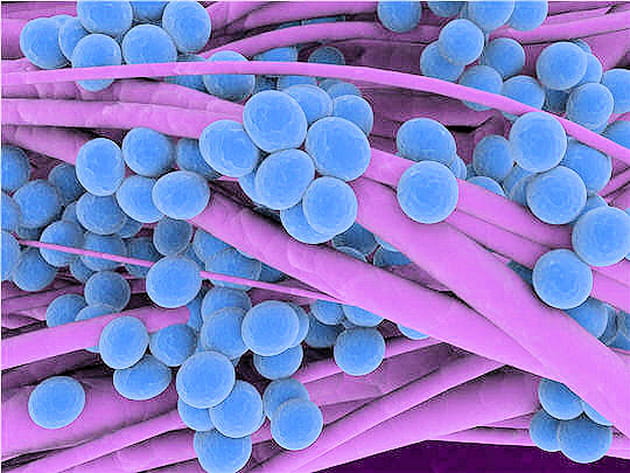 Le staphylocoque, ennemi juré des hôpitaux