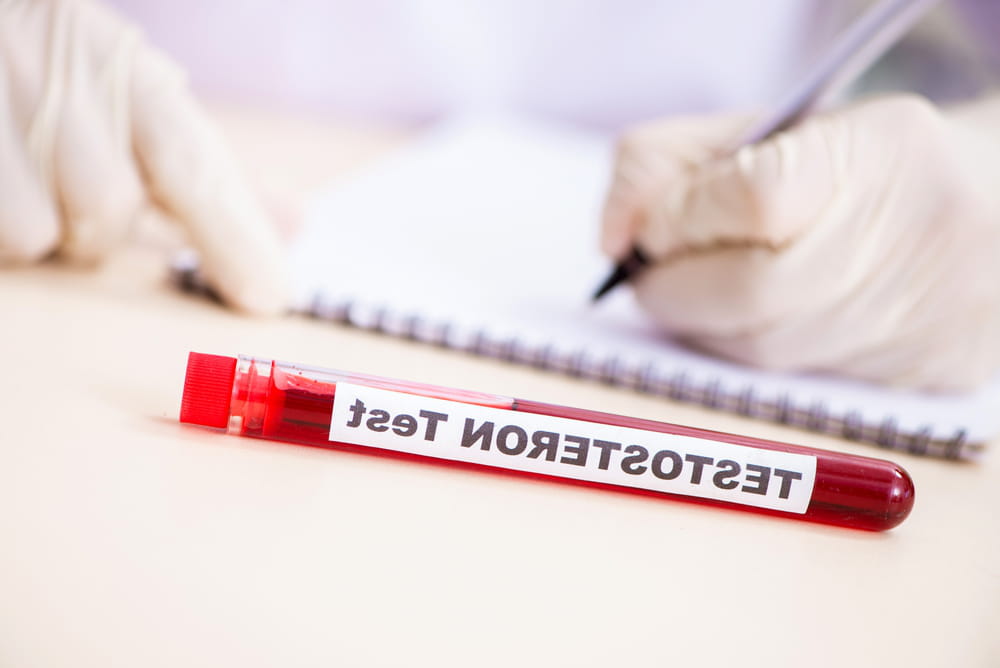Réactions à l’article : « C'est quoi la testostérone ? Définition, rôle ...
