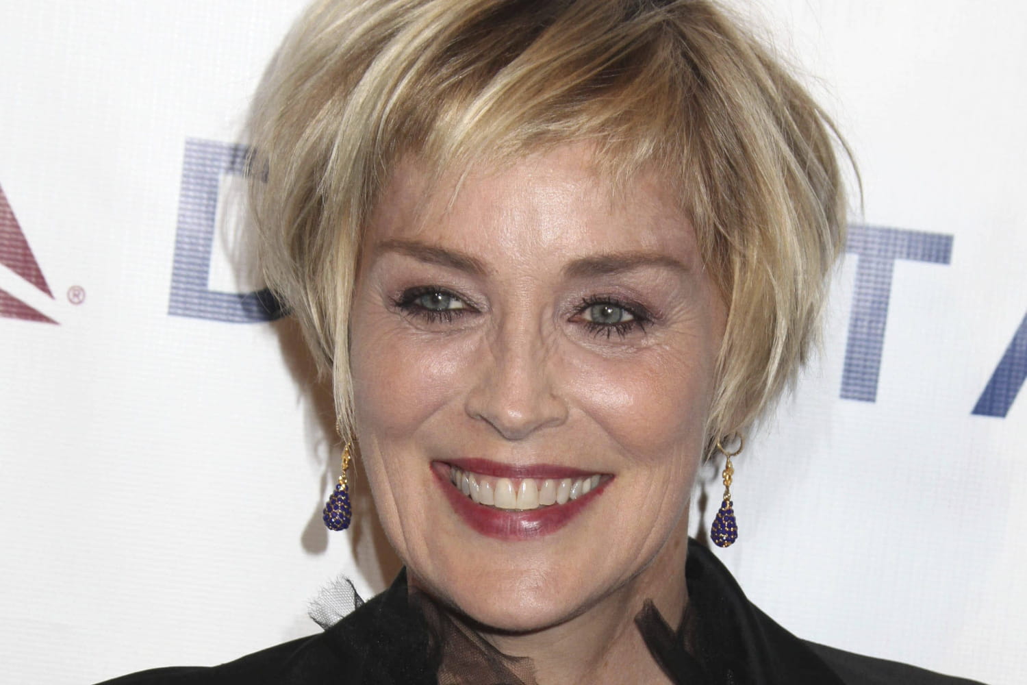 Fibrome utérin : qu'est-ce qu'une tumeur fibroïde