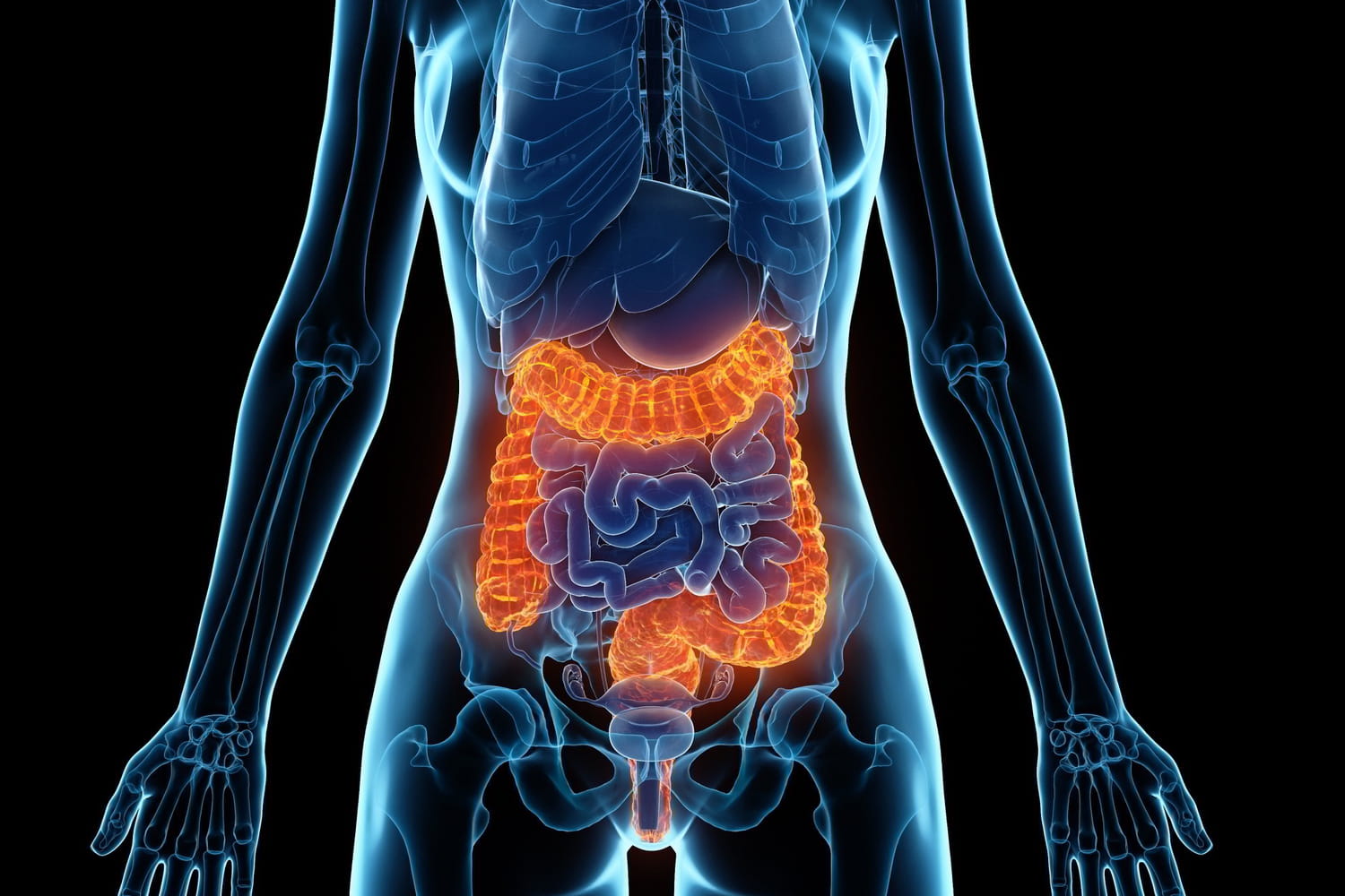 Maladie De Crohn Sympt mes Pouss e Causes H r ditaire Maladie De Crohn Sympt mes Pouss e Causes H r ditaire