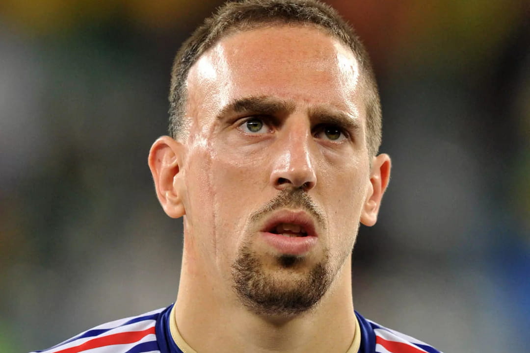 Franck Ribéry a des cicatrices au visage