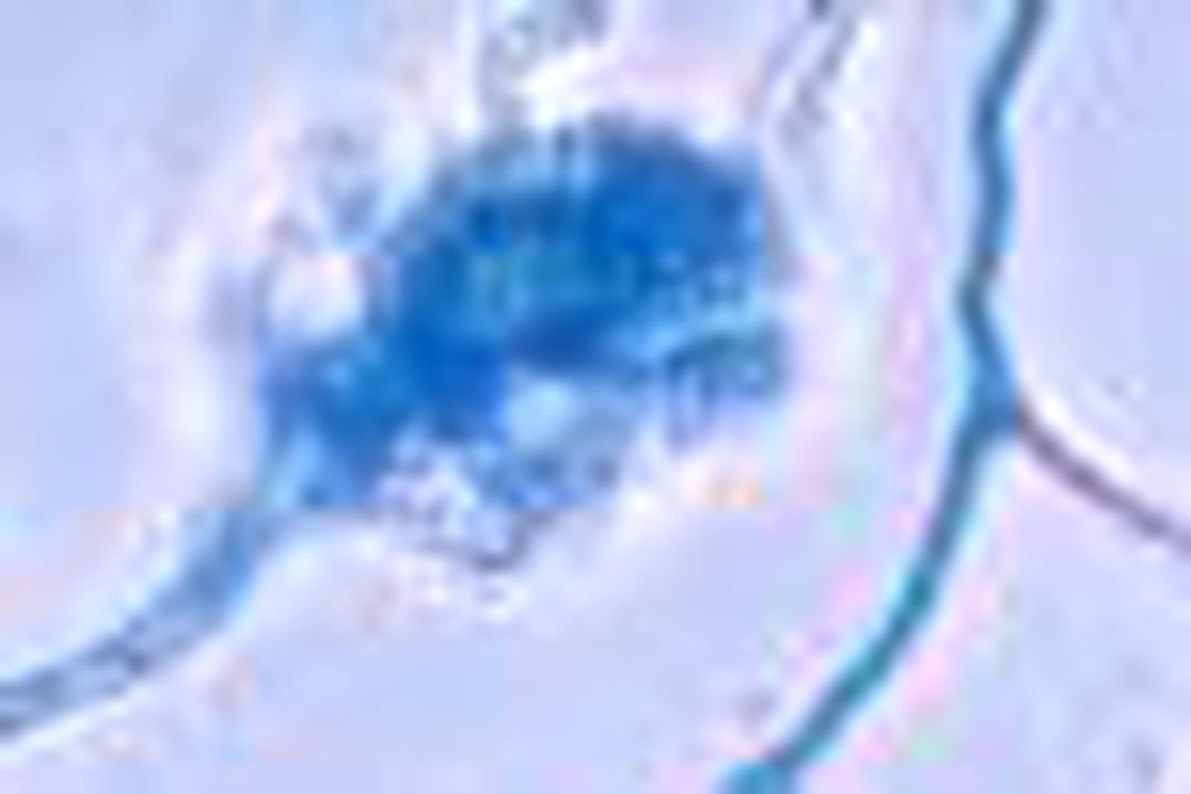 Un parasite opportuniste