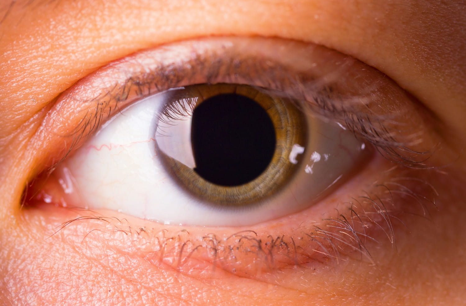 Dilatation Des Pupilles Signification Dur e Que Faire Dilatation Des Pupilles Signification Dur e Que Faire