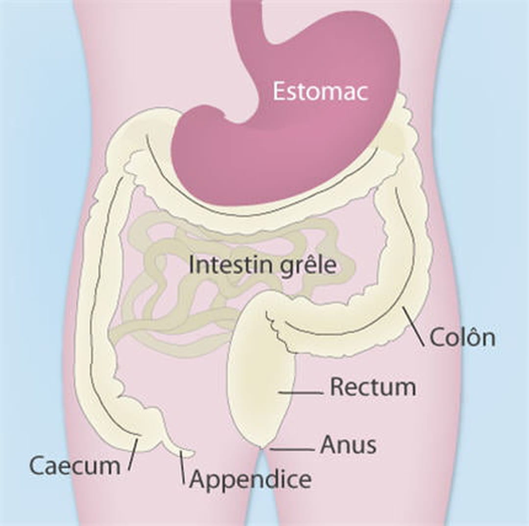 Appendicite Causes Sympt mes Op ration Cicatrice Appendicite Causes Sympt mes Op ration Cicatrice
