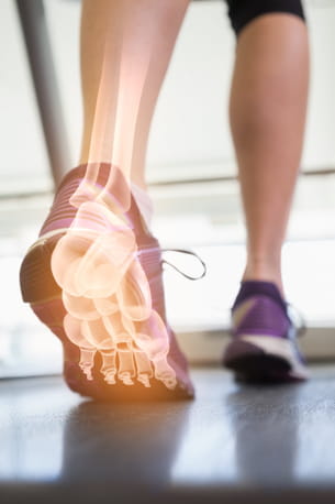 Douleur aux pieds : ce qu'elles révèlent