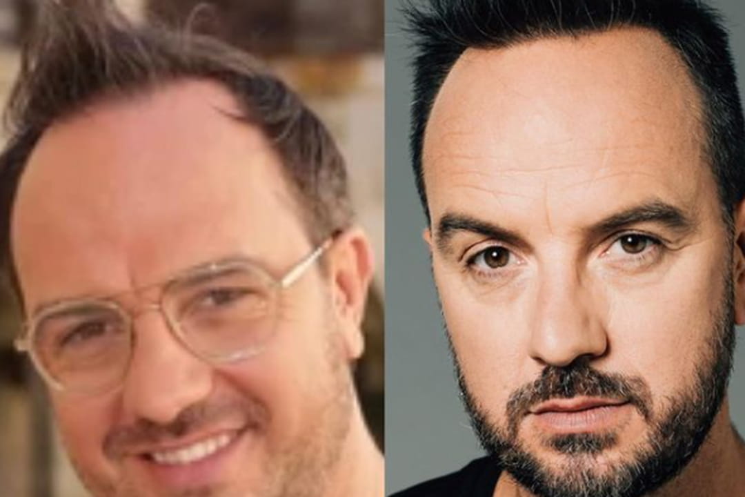 Jarry il y a sept ans: l'humoriste a bien changé, les fans sont bluffés