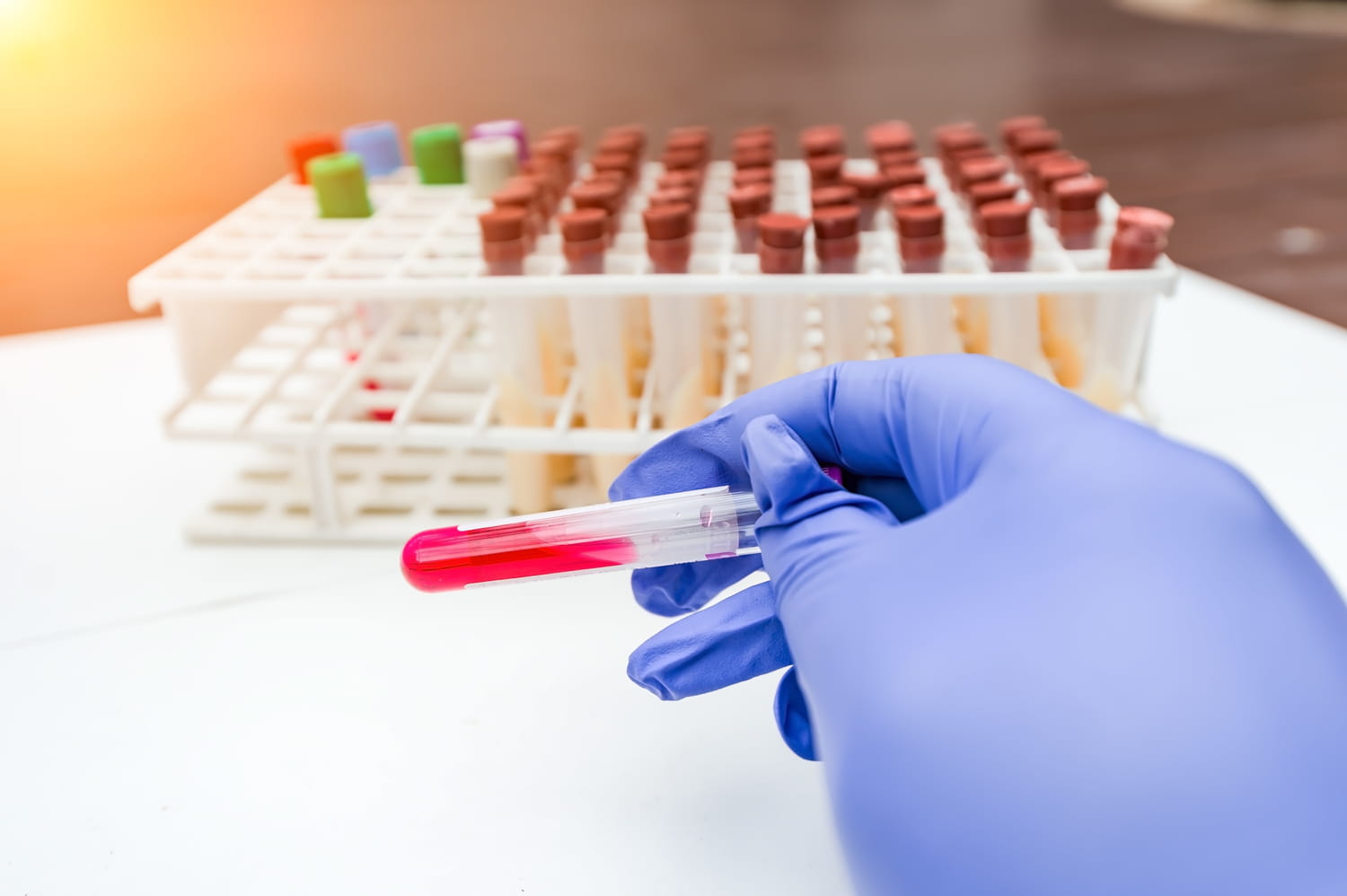 Plasma sanguin : définition, composition, couleur et rôle