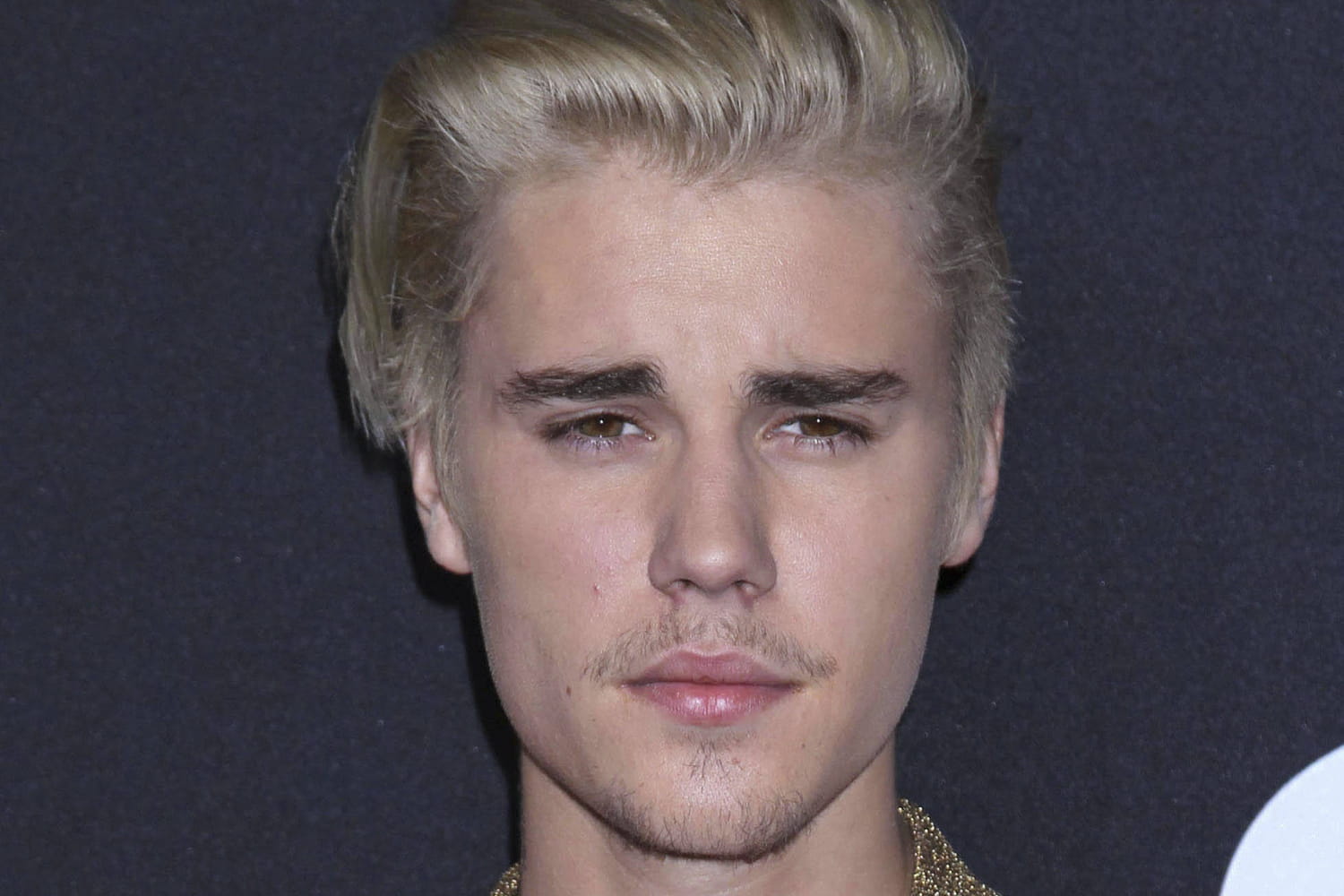 Syndrome de Ramsay Hunt : de quoi souffre Justin Bieber