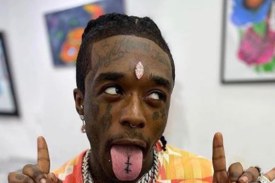 Le rappeur Lil Uzi Vert : son diamant de front, arraché