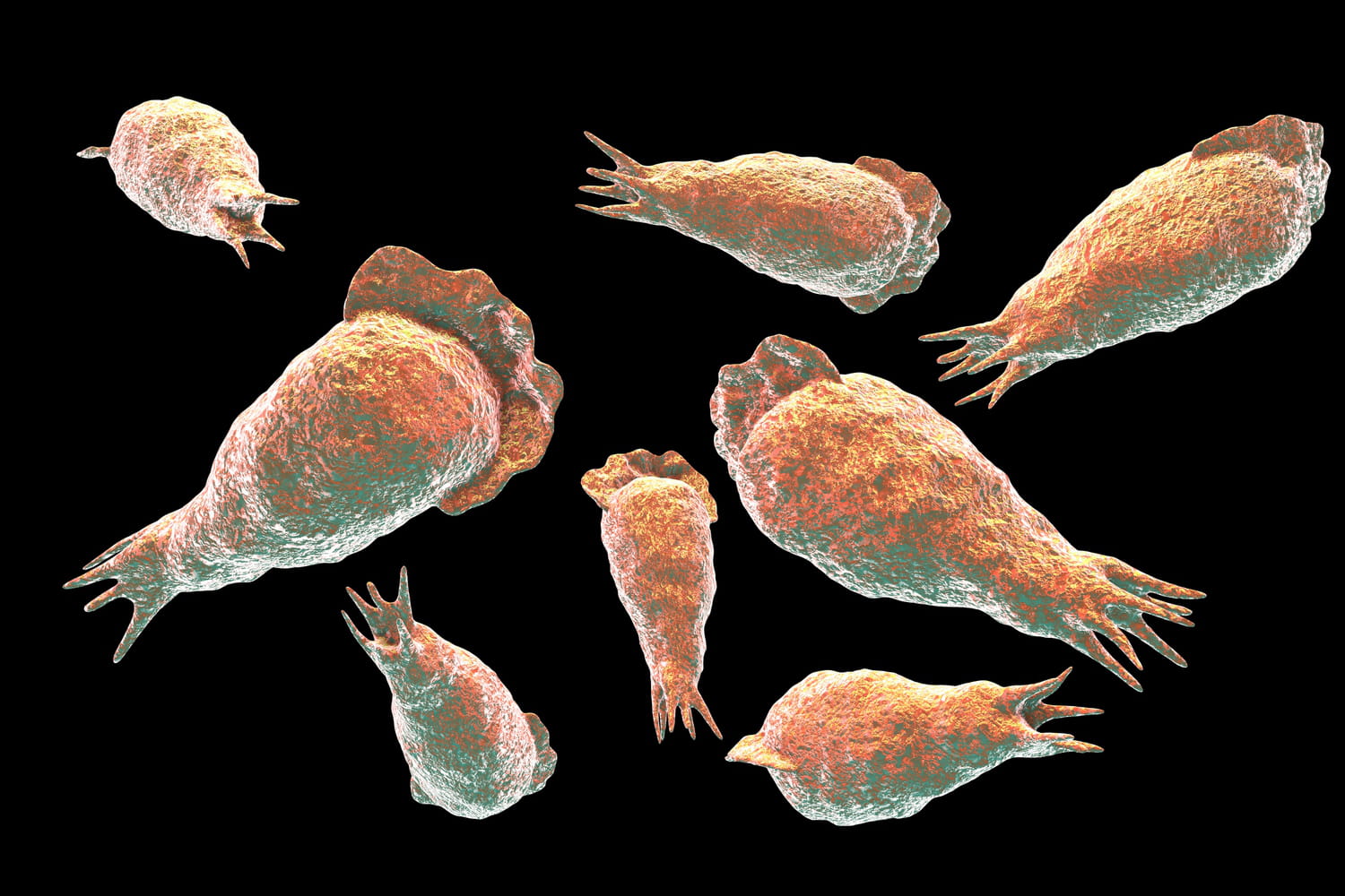 Amibe "mangeuse de cerveau" : décès, symptômes, en France