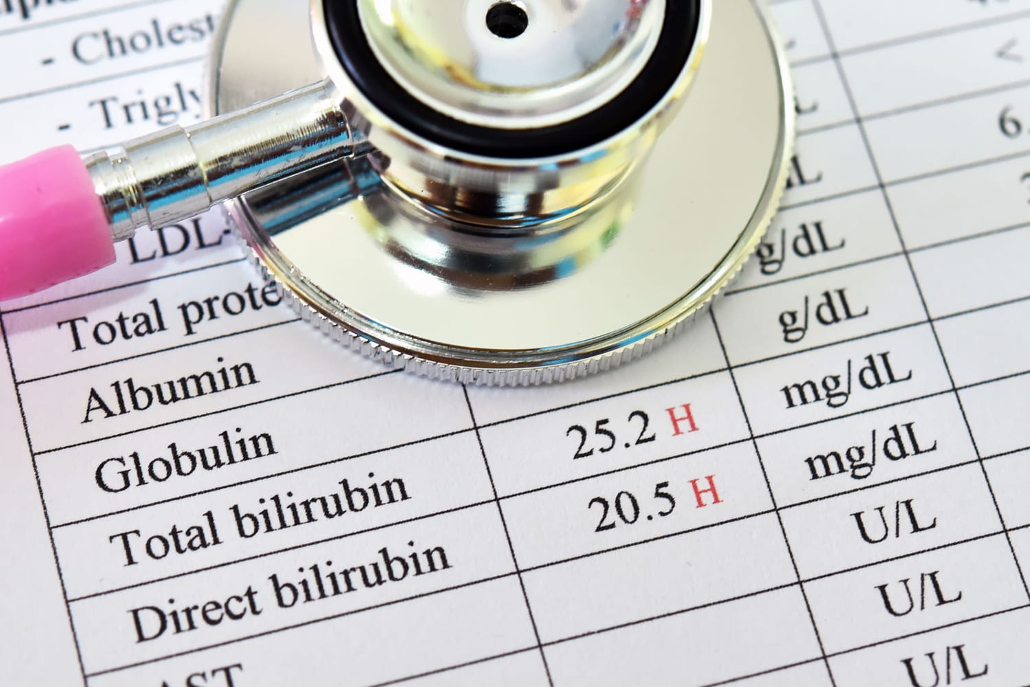 Ictère (jaunisse) : comment le soigner