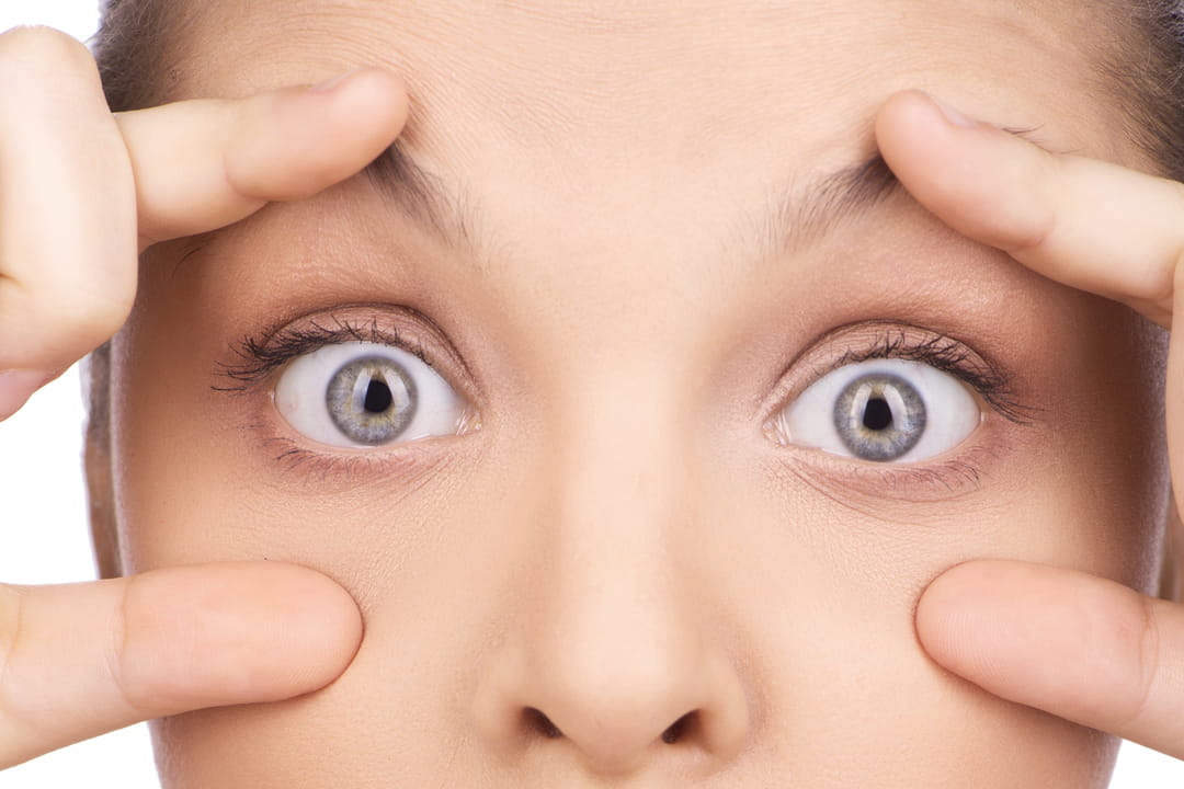 Maladie de Basedow : les yeux qui sortent des orbites