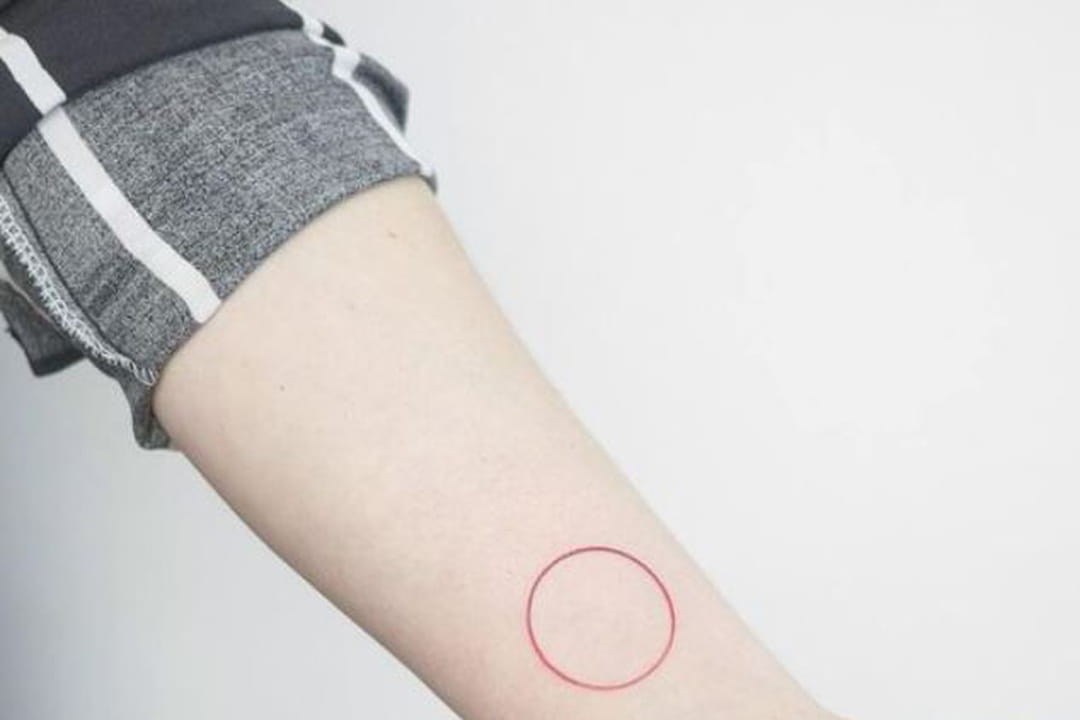 Cercle rouge sur le poignet