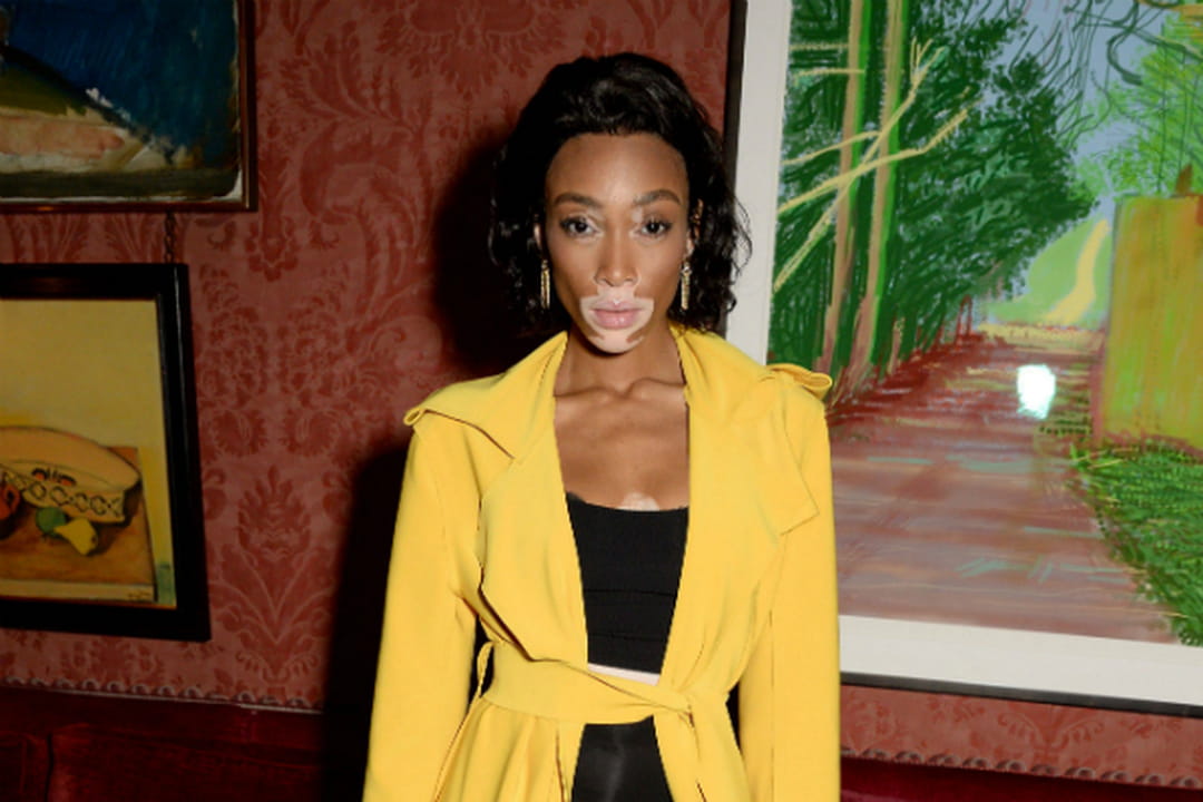 Winnie Harlow aux 10 ans de la marque Victoria Beckham